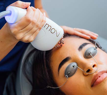 I Tried The Moxi™ Laser: What You Need To Know